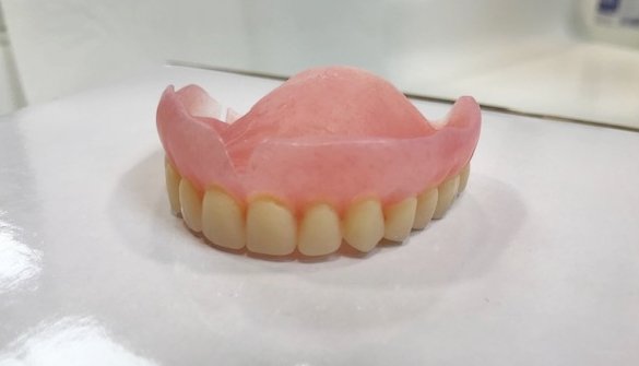 Fixed and Removal Dentures